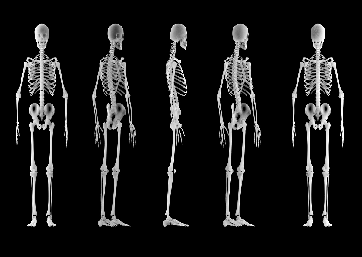 Osteoporosis Risks and Treatments | Brookdale Senior Living